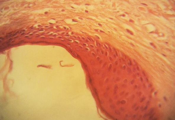 Synderm | Dr.Leila Roshangar – SynِDerm is an academic based tissue ...